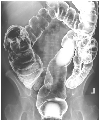 Radiographic Image Analysis