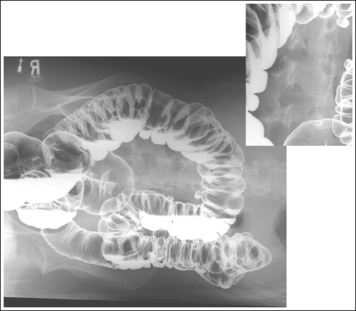 Radiographic Image Analysis