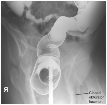 Radiographic Image Analysis