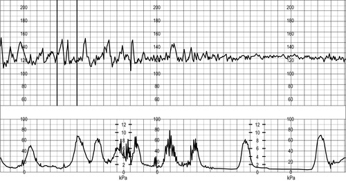 Principles of abdominal examination
