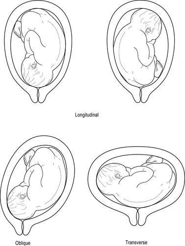 Principles of abdominal examination