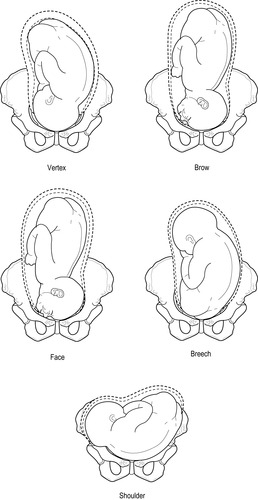 Principles of abdominal examination