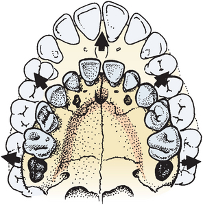 ESSENTIALS OF ORAL HISTOLOGY AND EMBRYOLOGY: A Clinical Approach