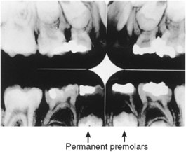 ESSENTIALS OF ORAL HISTOLOGY AND EMBRYOLOGY: A Clinical Approach