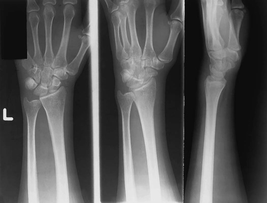 Textbook of Radiographic Positioning and Related Anatomy