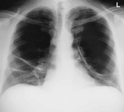 Textbook of Radiographic Positioning and Related Anatomy