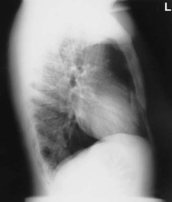 Textbook of Radiographic Positioning and Related Anatomy