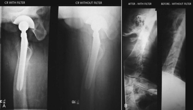 Textbook of Radiographic Positioning and Related Anatomy