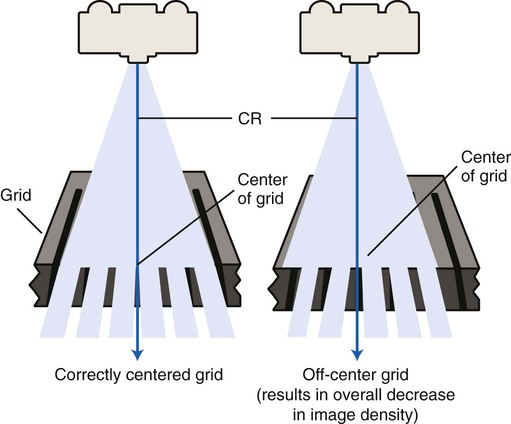 Textbook of Radiographic Positioning and Related Anatomy