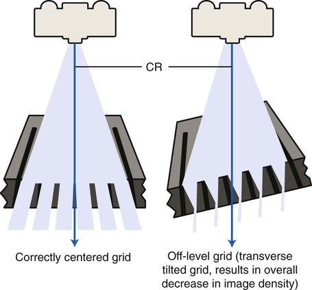 Textbook of Radiographic Positioning and Related Anatomy