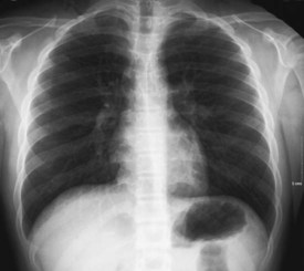 Textbook of Radiographic Positioning and Related Anatomy