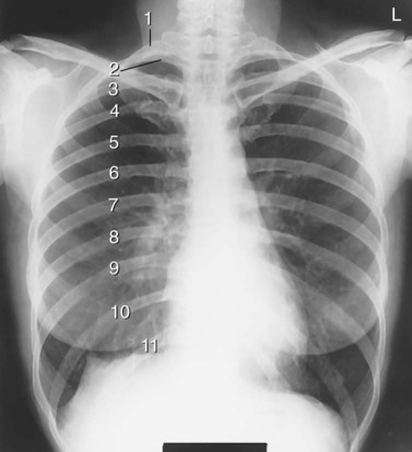 Textbook of Radiographic Positioning and Related Anatomy