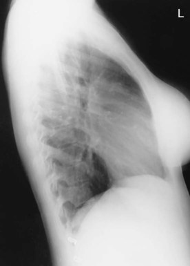 Textbook of Radiographic Positioning and Related Anatomy