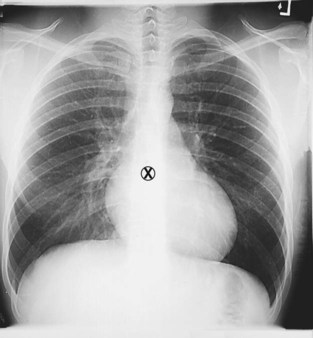 Textbook of Radiographic Positioning and Related Anatomy