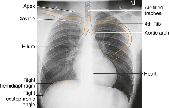 Textbook of Radiographic Positioning and Related Anatomy