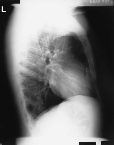 Textbook of Radiographic Positioning and Related Anatomy