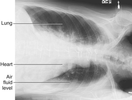 Textbook of Radiographic Positioning and Related Anatomy