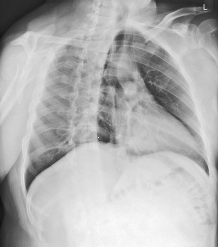Textbook of Radiographic Positioning and Related Anatomy