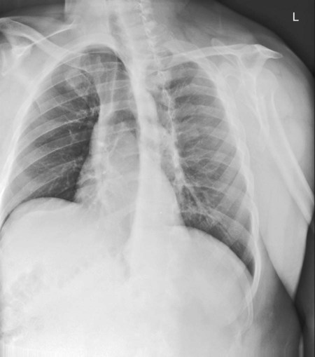 Textbook of Radiographic Positioning and Related Anatomy