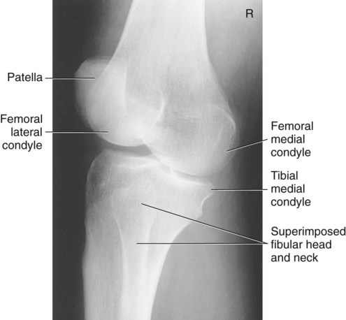 Textbook of Radiographic Positioning and Related Anatomy