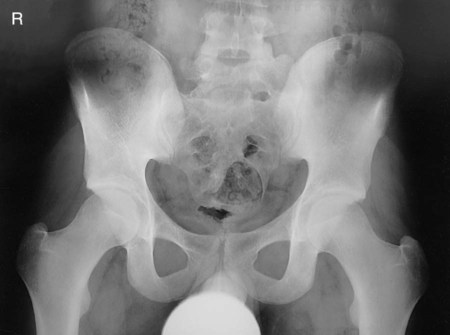 Textbook of Radiographic Positioning and Related Anatomy