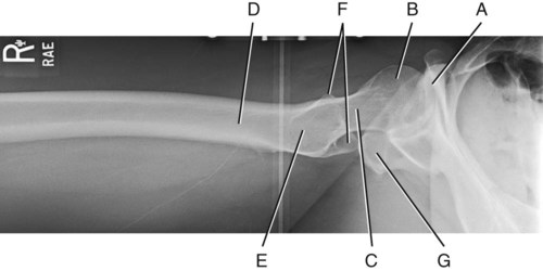 Textbook of Radiographic Positioning and Related Anatomy