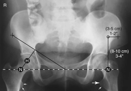 Textbook of Radiographic Positioning and Related Anatomy