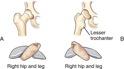 Textbook of Radiographic Positioning and Related Anatomy