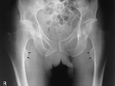 Textbook of Radiographic Positioning and Related Anatomy