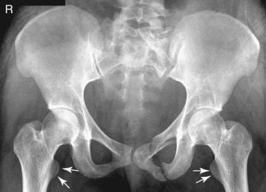 Textbook of Radiographic Positioning and Related Anatomy