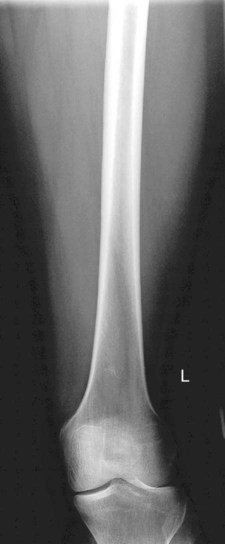 Textbook of Radiographic Positioning and Related Anatomy