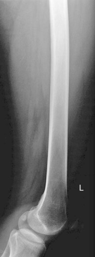 Textbook of Radiographic Positioning and Related Anatomy