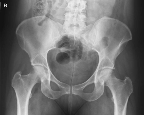 Textbook of Radiographic Positioning and Related Anatomy