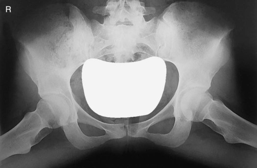 Textbook of Radiographic Positioning and Related Anatomy
