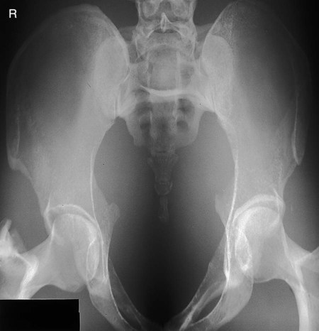 Textbook of Radiographic Positioning and Related Anatomy