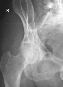 Textbook of Radiographic Positioning and Related Anatomy