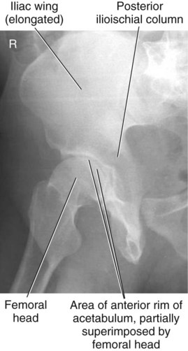 Textbook of Radiographic Positioning and Related Anatomy