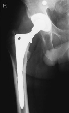 Textbook of Radiographic Positioning and Related Anatomy