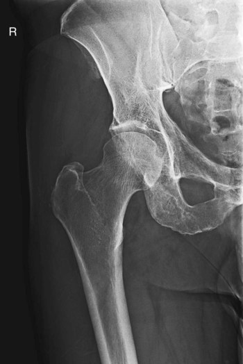 Textbook of Radiographic Positioning and Related Anatomy