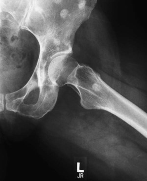 Textbook of Radiographic Positioning and Related Anatomy