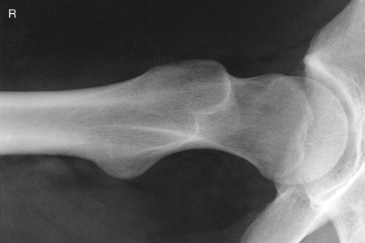 Textbook of Radiographic Positioning and Related Anatomy