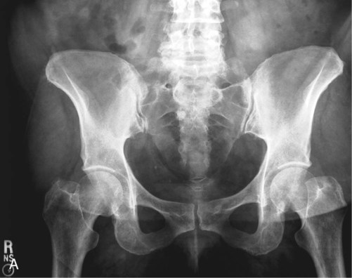 Textbook of Radiographic Positioning and Related Anatomy