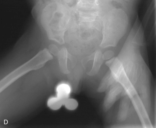 Textbook of Radiographic Positioning and Related Anatomy