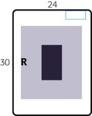 Textbook of Radiographic Positioning and Related Anatomy