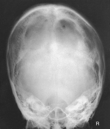 Textbook of Radiographic Positioning and Related Anatomy