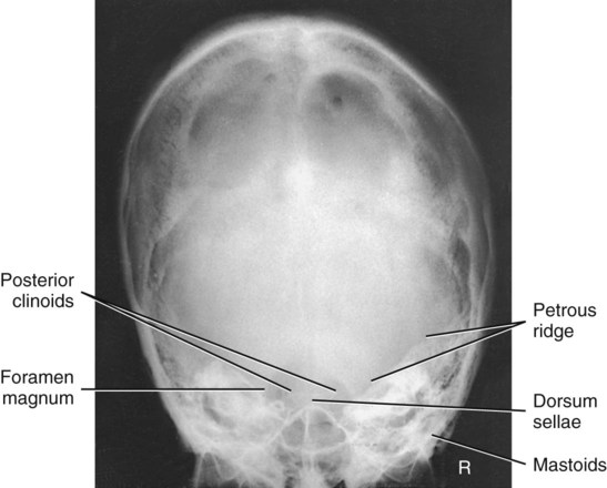 Textbook of Radiographic Positioning and Related Anatomy