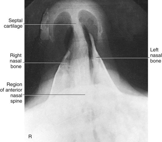 Textbook of Radiographic Positioning and Related Anatomy