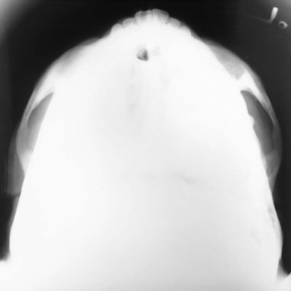 Textbook of Radiographic Positioning and Related Anatomy