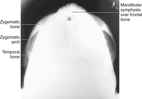 Textbook of Radiographic Positioning and Related Anatomy