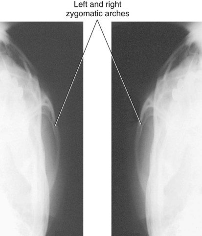 Textbook of Radiographic Positioning and Related Anatomy